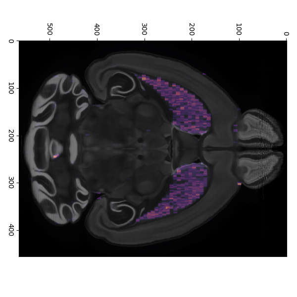 spatial-brain-maps · PyPI