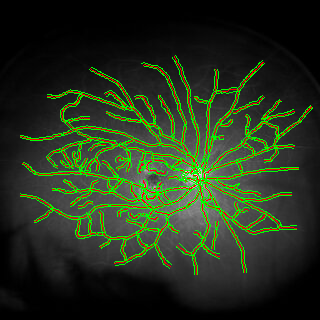 ridge-detector · PyPI