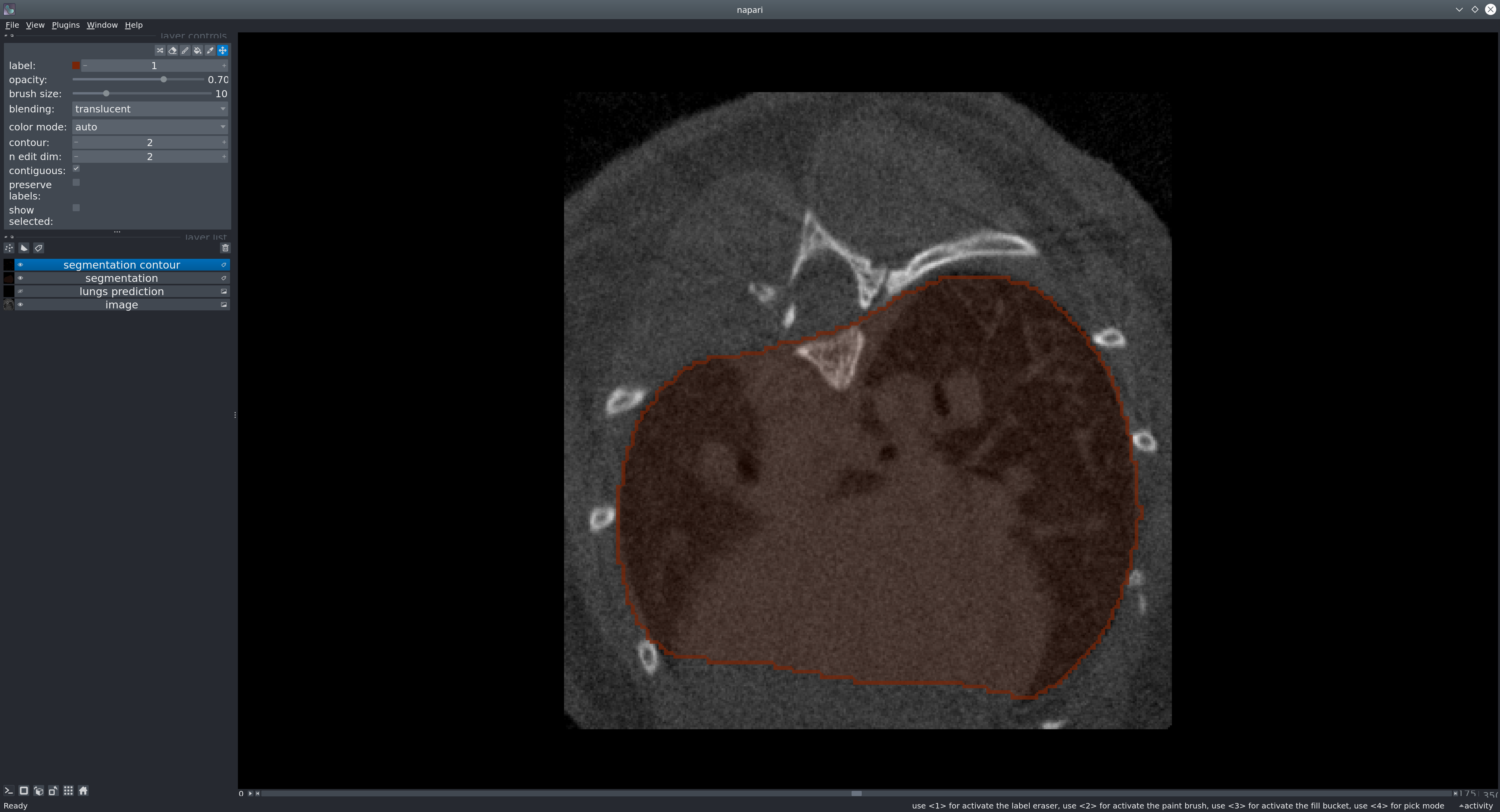 unet-lungs-segmentation · PyPI