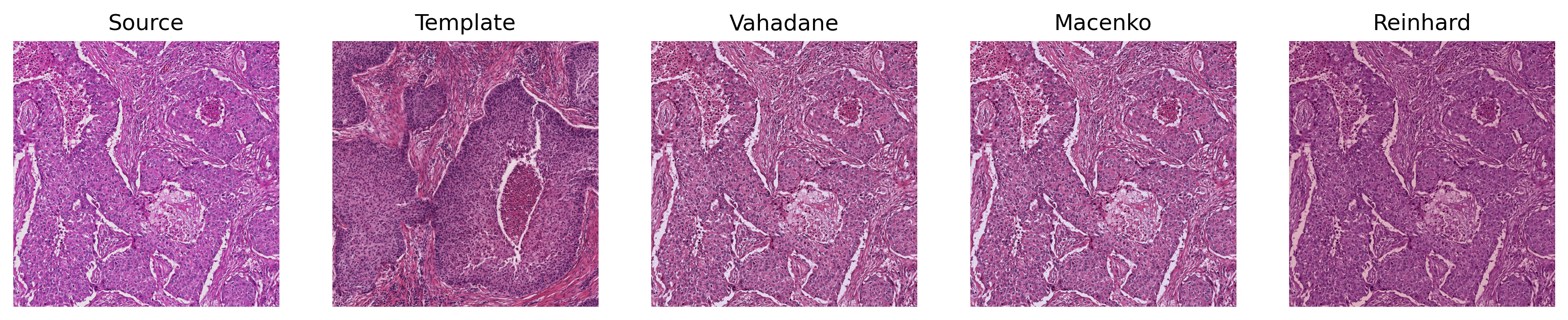 torch-staintools · PyPI