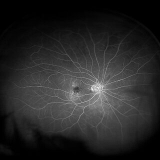 ridge-detector · PyPI