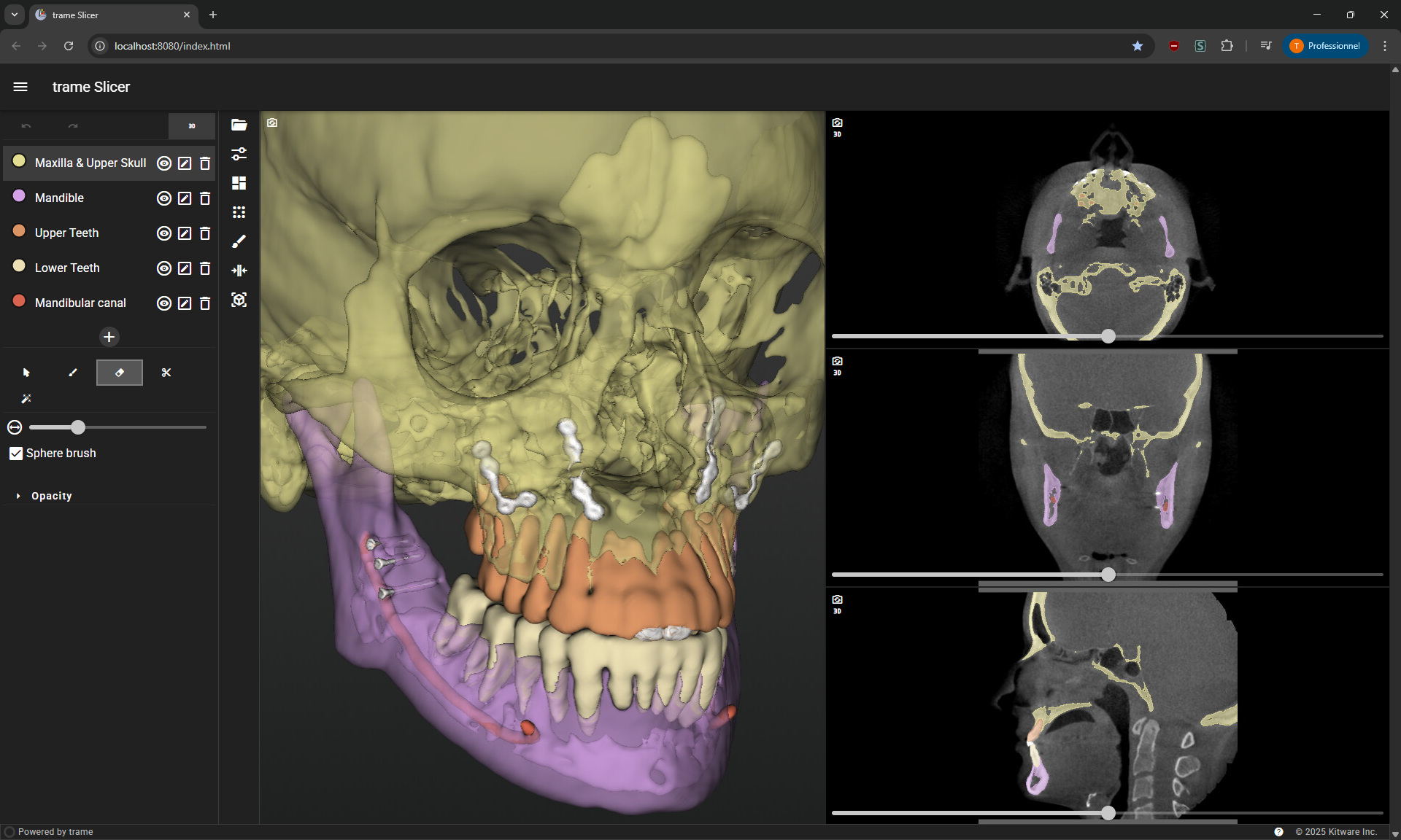 trame-slicer · PyPI